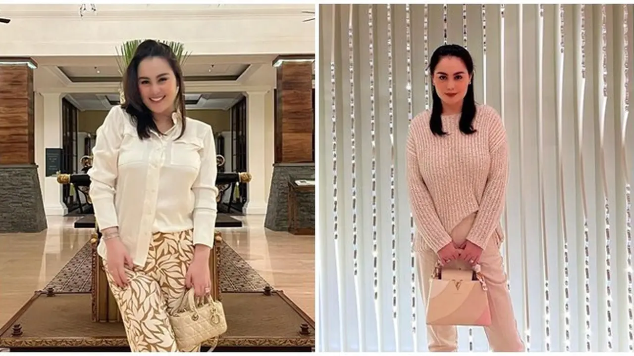 6 Potret Beda Penampilan Jennifer Dunn Sebelum dan Setelah Operasi ...