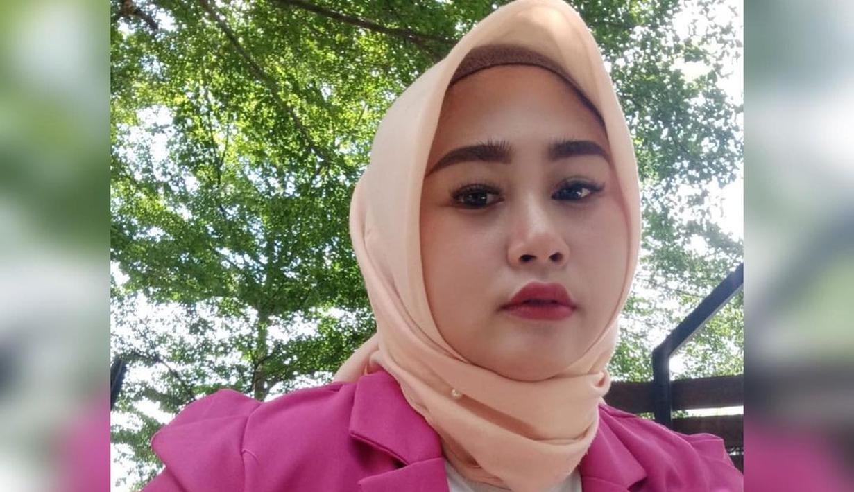 Potret Close Up Shelvie Hana Wijaya, Istri Daus Mini yang Gugat Cerai ...