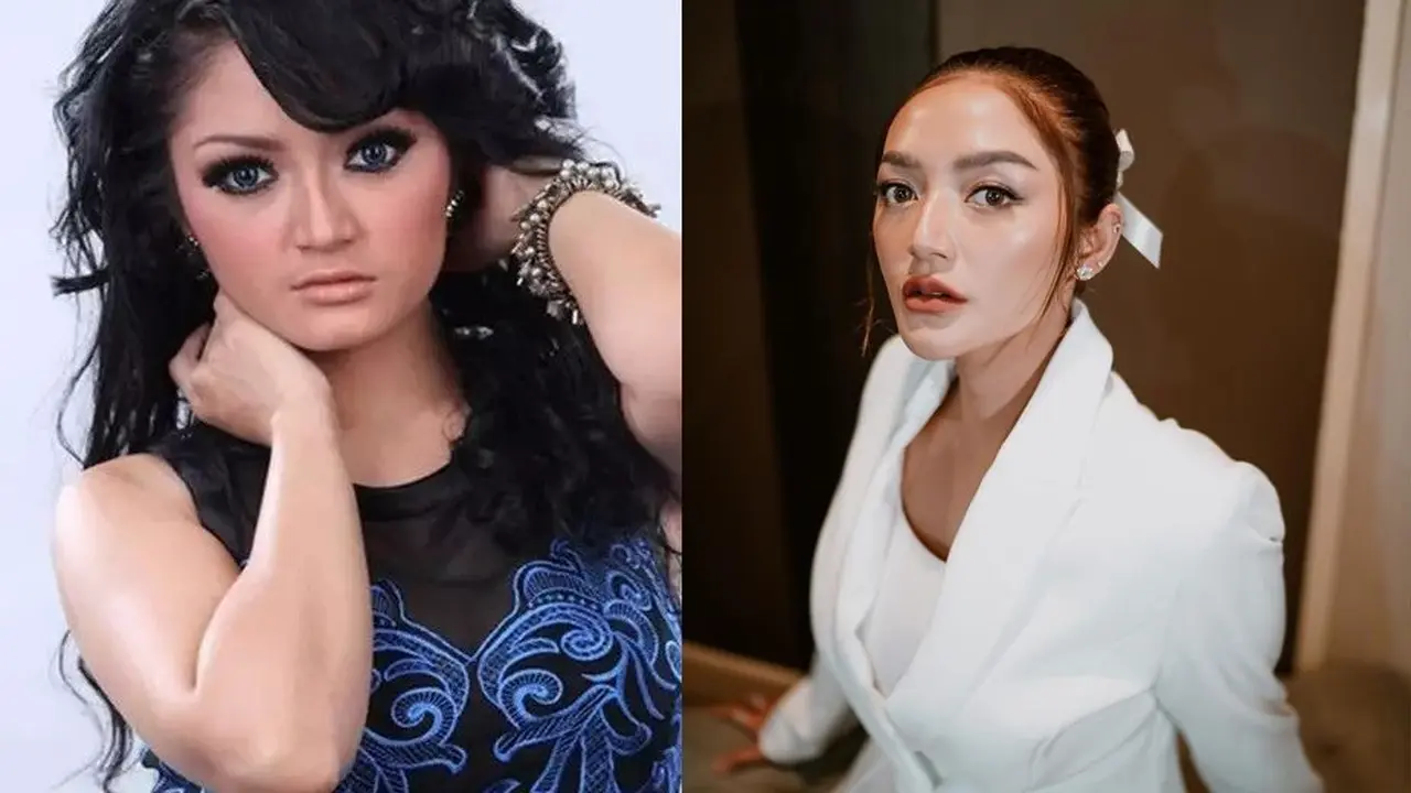 Filler Bibir Berujung Ketagihan? Intip 10 Transformasi Artis Ini ...