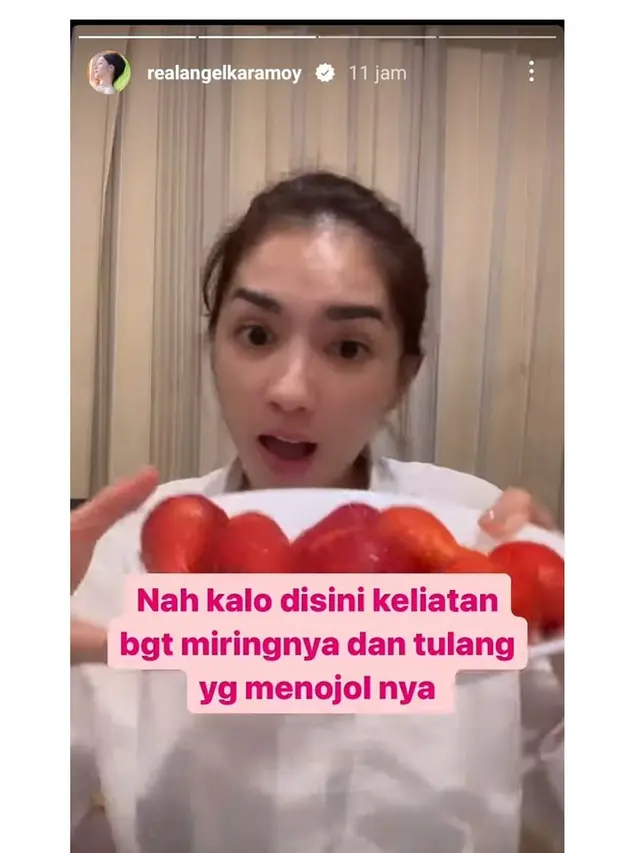 8 Potret Angel Karamoy Sebelum vs Setelah Operasi Plastik, Hasilnya ...