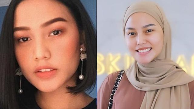 Beda Penampilan 9 Artis Sebelum vs Setelah Operasi Plastik, Bikin ...