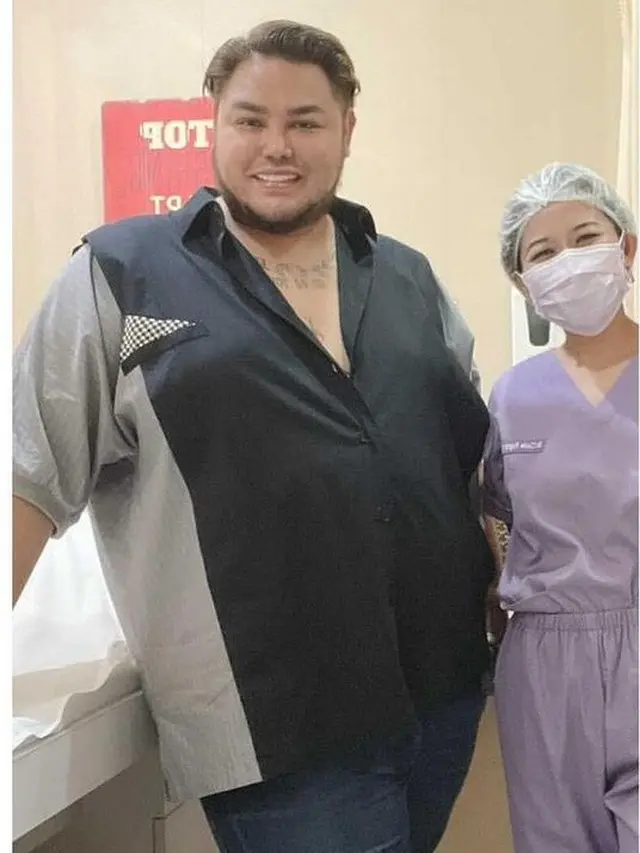 6 Potret Transformasi Ivan Gunawan Selama Diet, Turun hingga 30 Kg ...