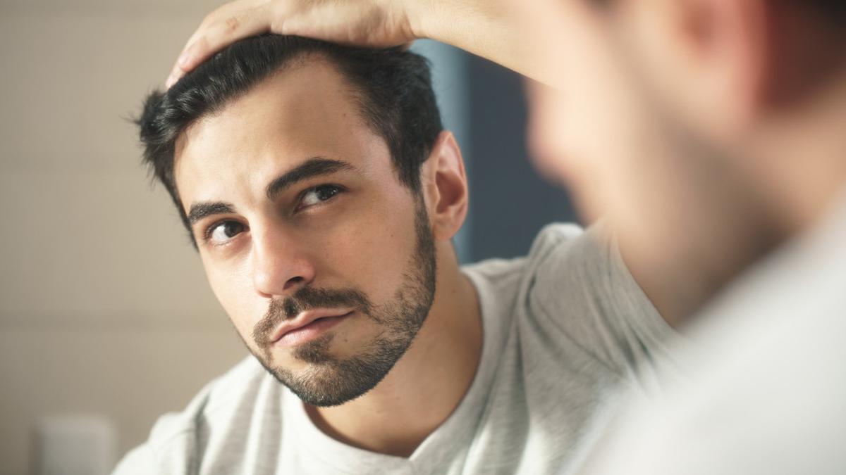 Kebotakan Bisa Melanda Siapa Saja, Waspadai Tanda-Tandanya! - Health ...