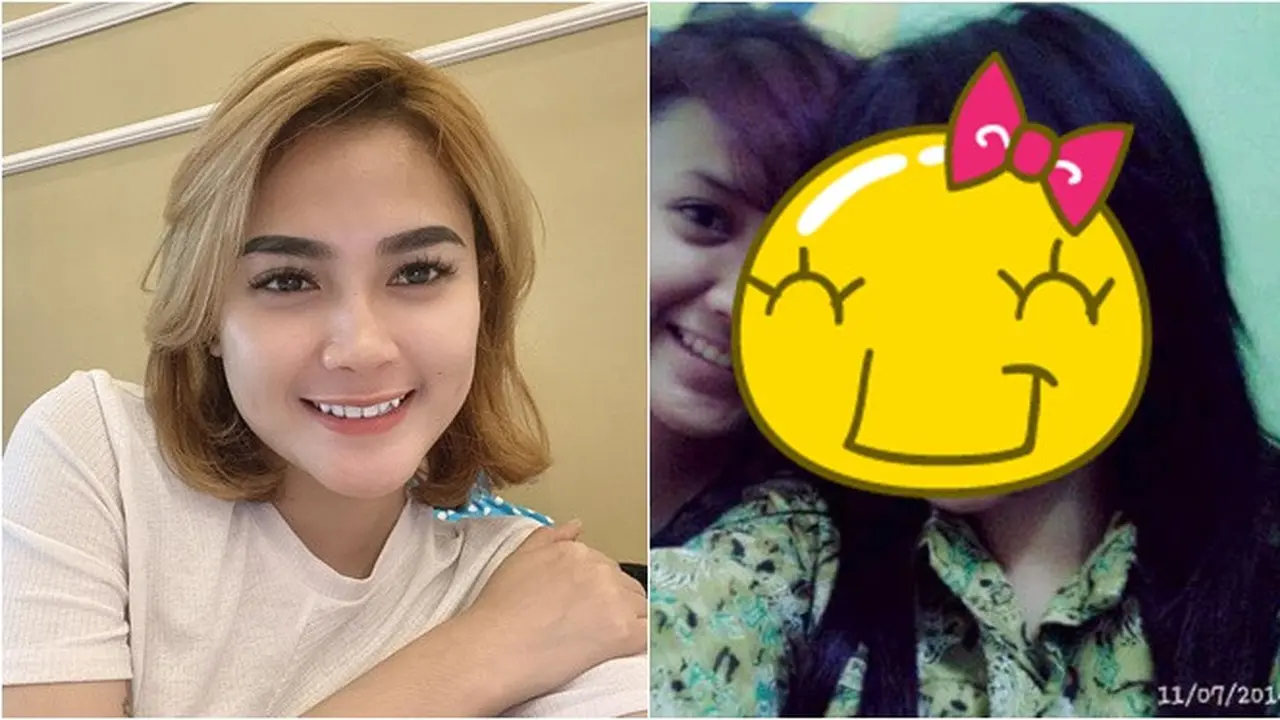 7 Potret Lawas Pedangdut Arlida Putri, Bukti Cantik Sedari Dulu - Surabaya Liputan6.com