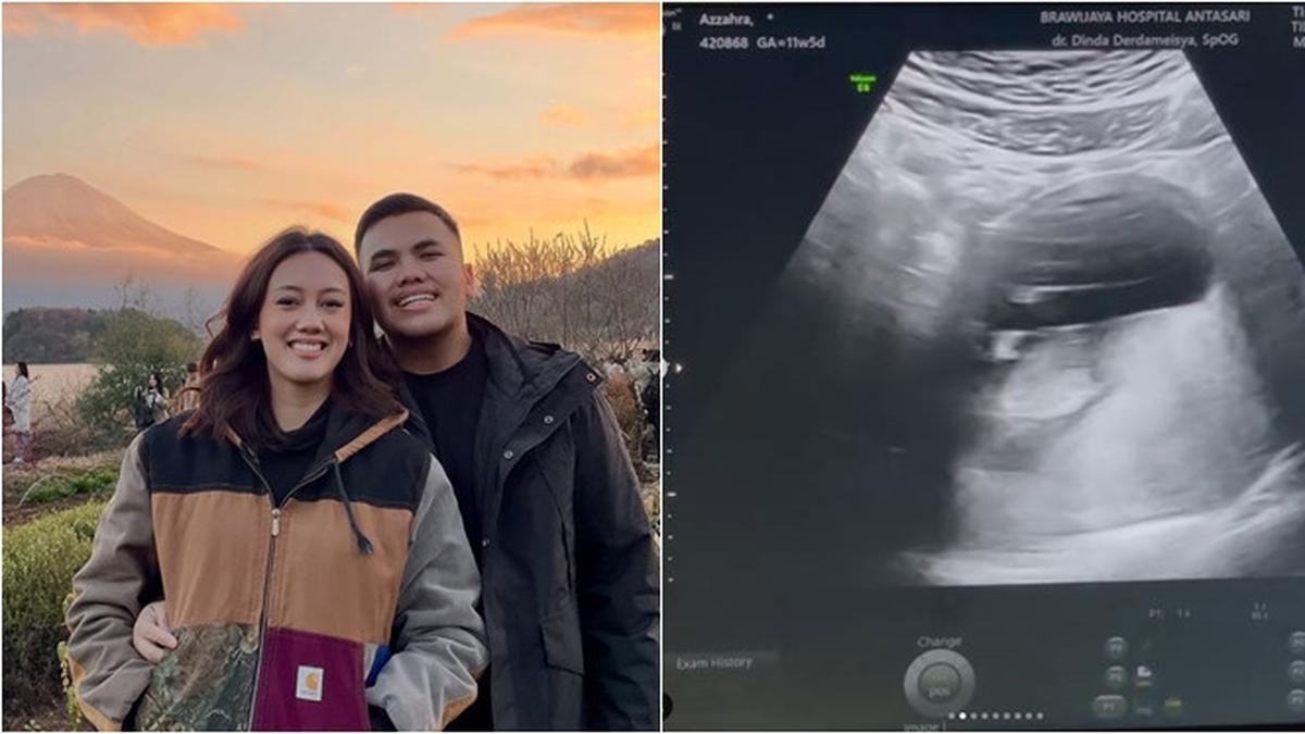 6 Potret Nabila Sudiro Umumkan Kehamilan Pertama, Tora Sudiro Segera ...