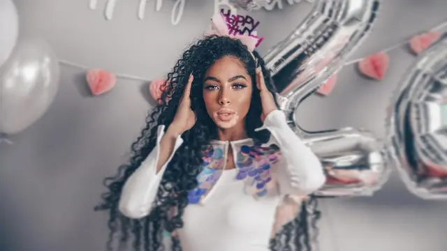 Shahad Salman, Model Pengidap Vitiligo yang Jadi Cover Vogue Arab ...