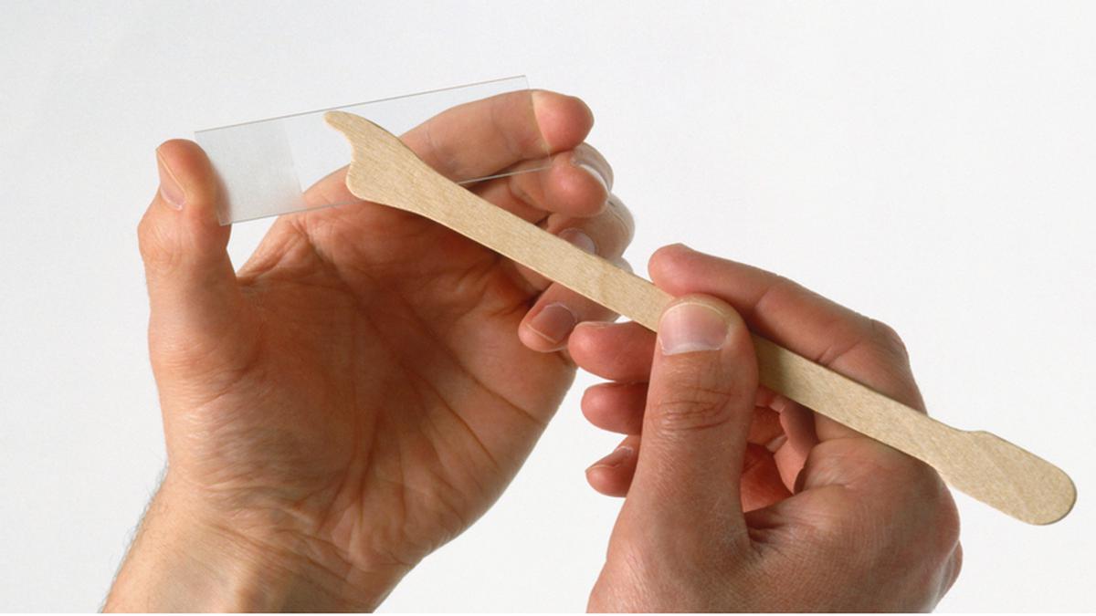 Kapan Saat Terbaik Melakukan Pap Smear? - Health Liputan6.com