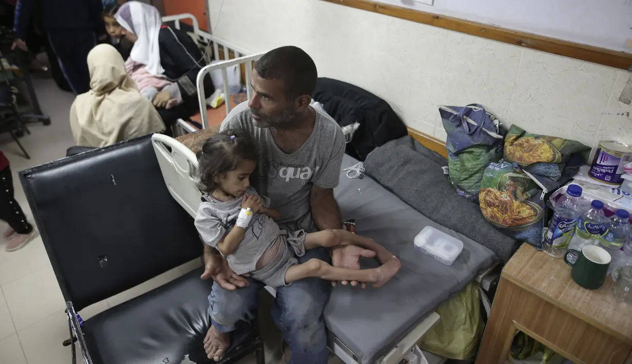 Anak-anak Palestina Menderita Malnutrisi Akut - Foto Liputan6.com