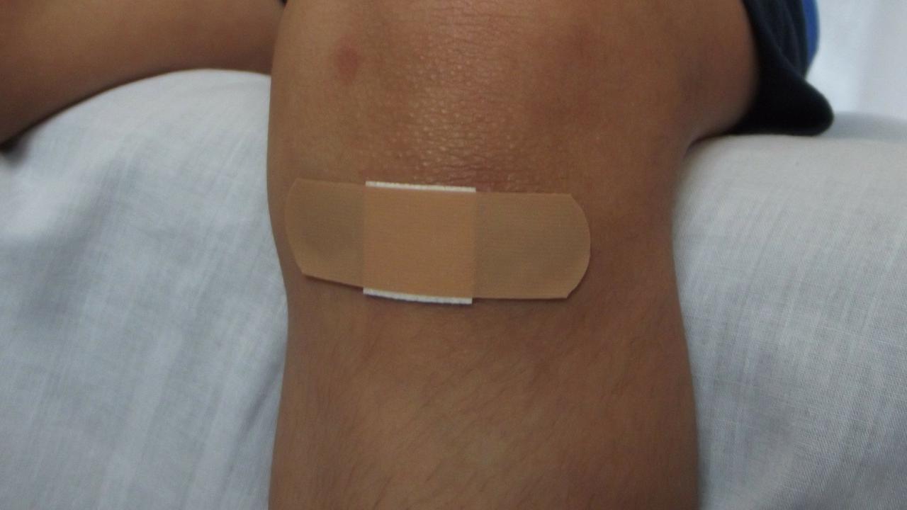 Luka Lecet Terlihat Ringan tapi Bisa Infeksi, Ini Cara Mengobatinya ...