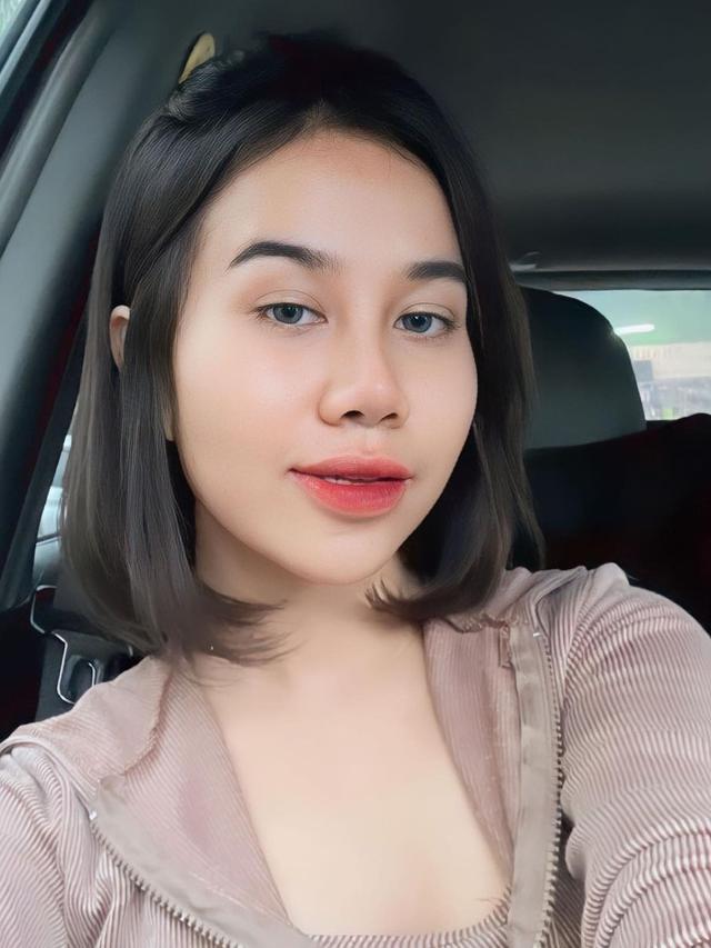 8 Potret Perubahan Wajah Mayang Usai Operasi Hidung, Sudah Lepas Perban ...