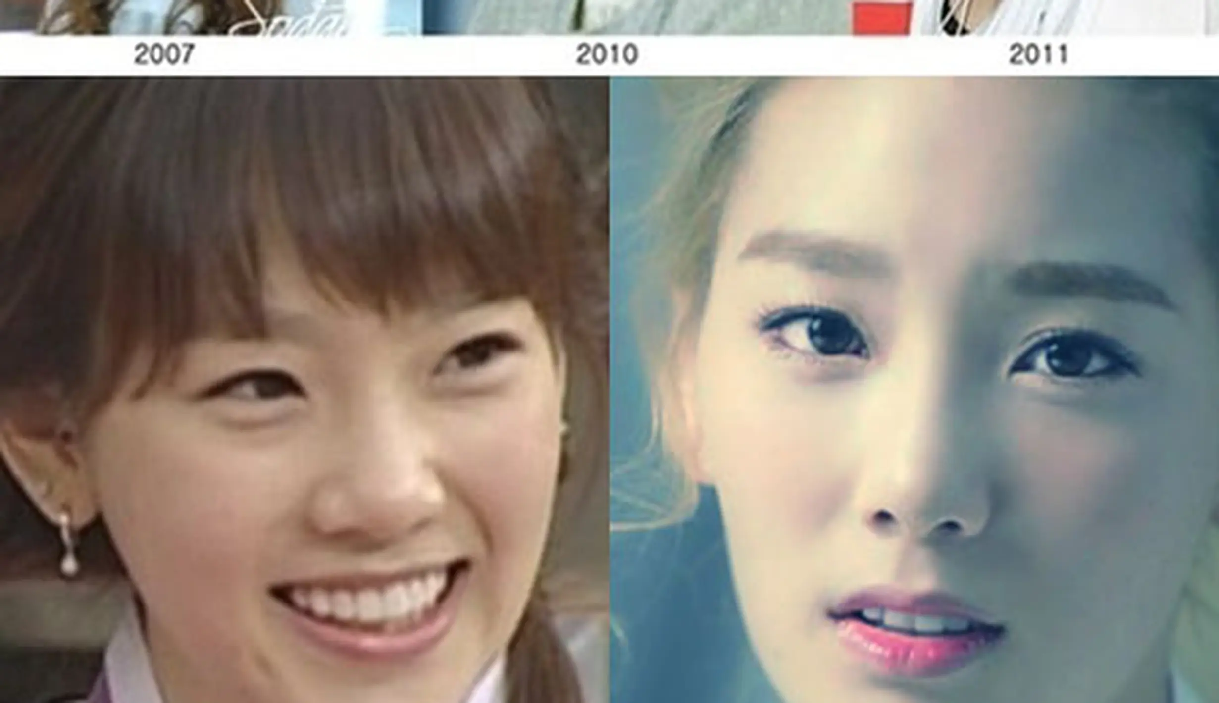 10 Artis Korea Cantik Karena Operasi Plastik? - Photo Fimela.com