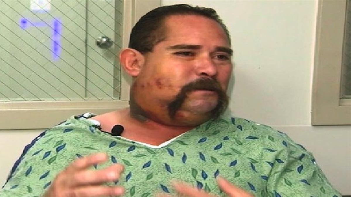 Gagal Masak Ular Barbeku, Victor Malah Nyaris Tewas Terpatuk - Health ...