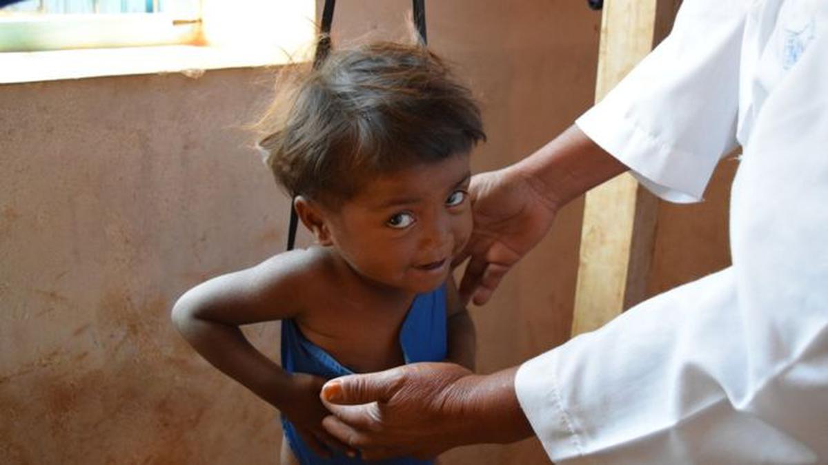 Misteri 'Berhentinya' Tumbuh Kembang Anak-Anak Madagaskar