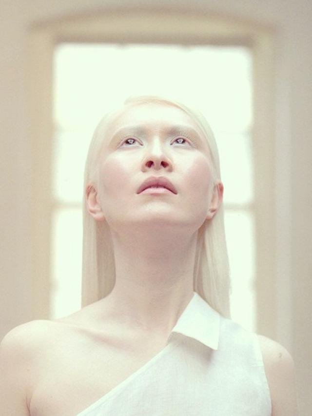 Connie Chiu, model albino yang mengubah perbedaan jadi kelebihan ...