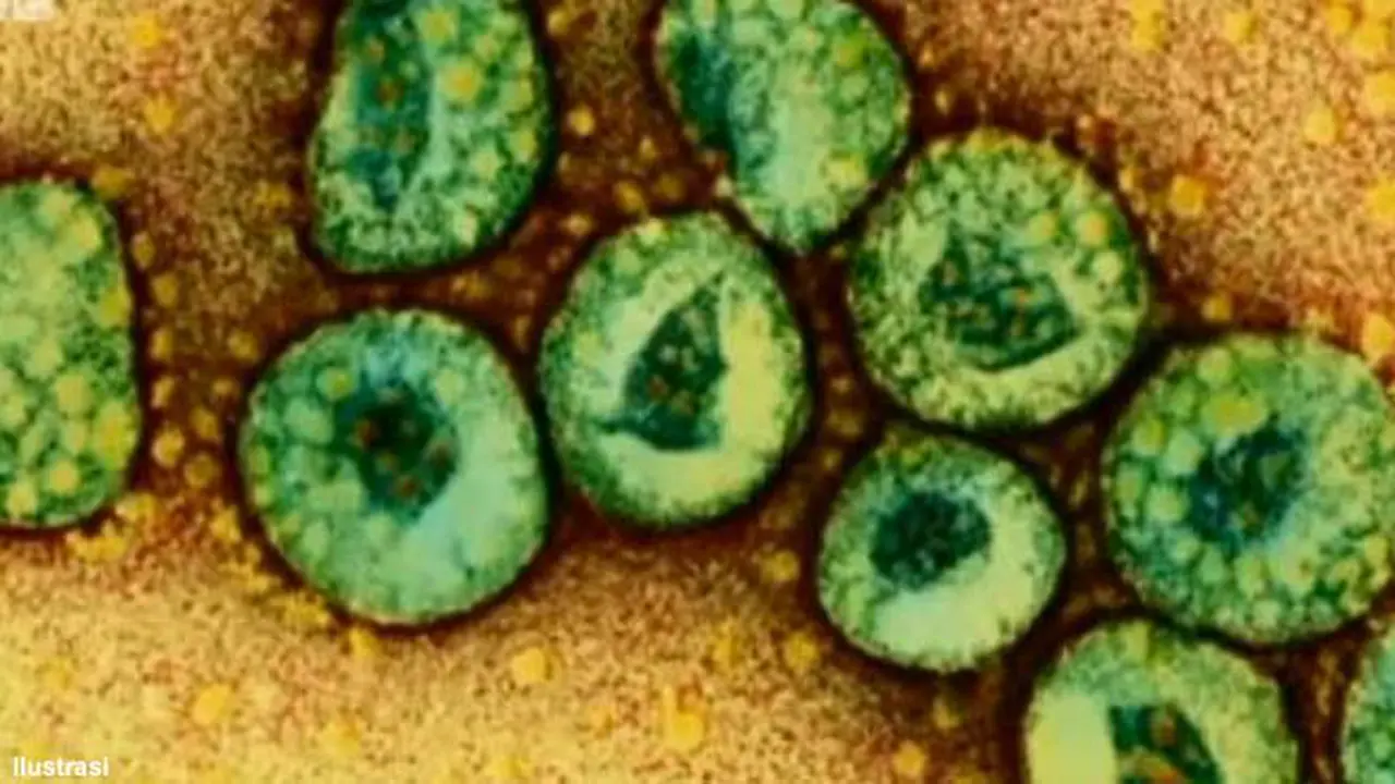 26 Macam-Macam Virus pada Manusia, Simak yang Paling Mematikan di Dunia ...