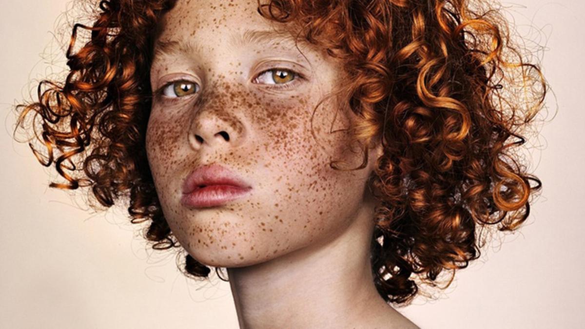 Freckles Muncul di Wajah Karena Alasan Ilmiah, Simak di Sini - Fashion ...