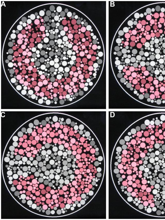 5 Jenis Tes Buta Warna yang Sering Digunakan, Ketahui Tekniknya - Hot ...