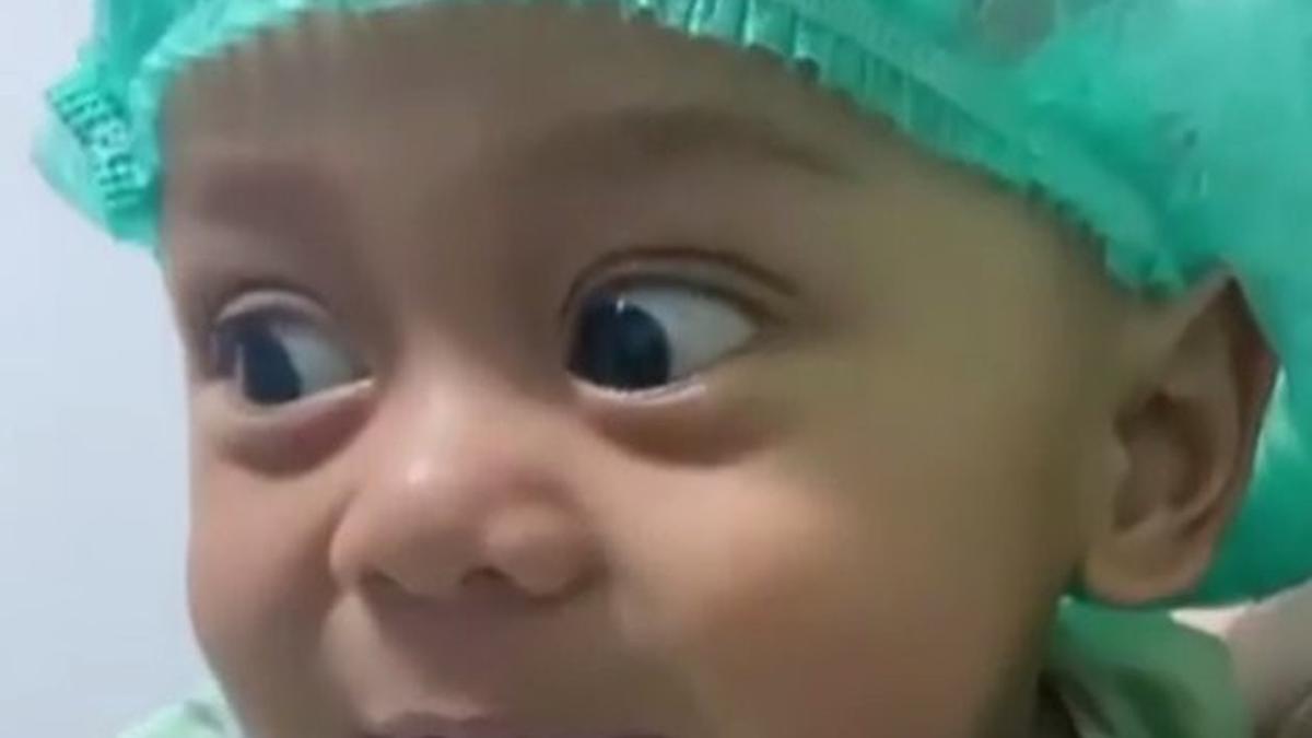 6 Potret Baby Leslar Usai Jalani Operasi, Senyumnya Buat Netizen Lega ...