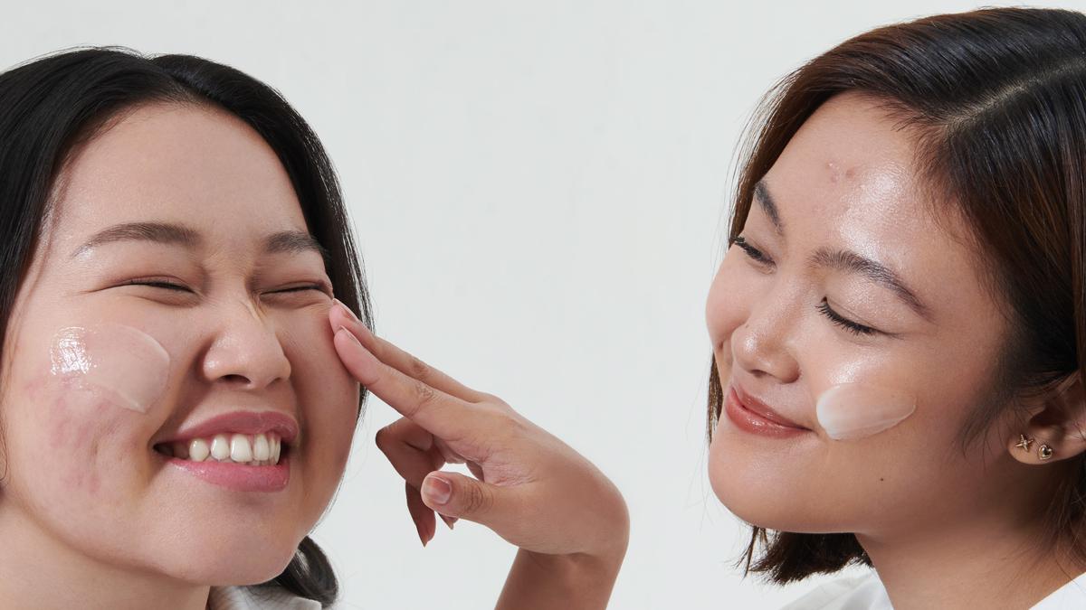 Solusi Merawat Kulit Berjerawat Jadi Kunci Meningkatkan Kepercayaan ...