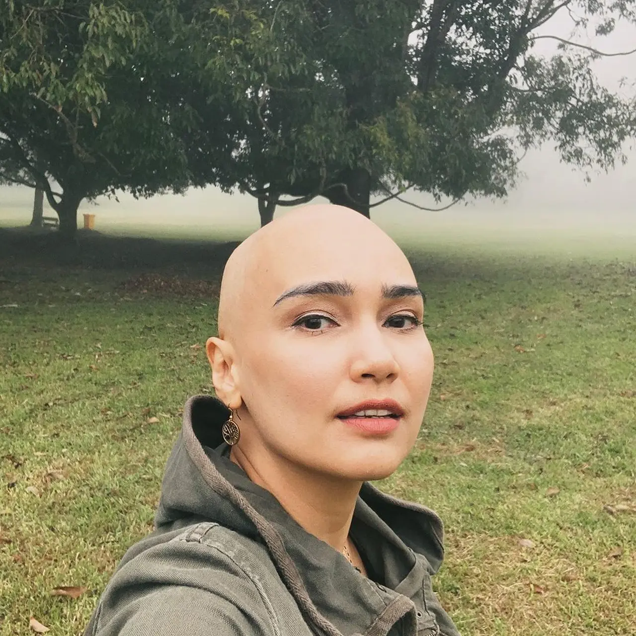 5 Fakta Feby Febiola Dinyatakan Sembuh dari Kanker Ovarium - ShowBiz ...