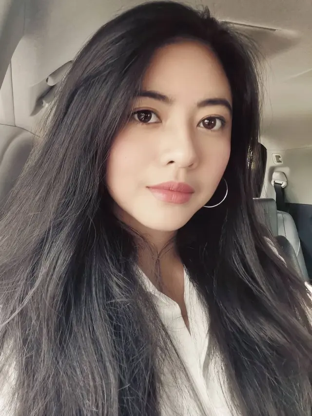 Qory Sandioriva Berjuang Lawan Autoimun, Sempat Koma 3 Hari dan Bobot ...