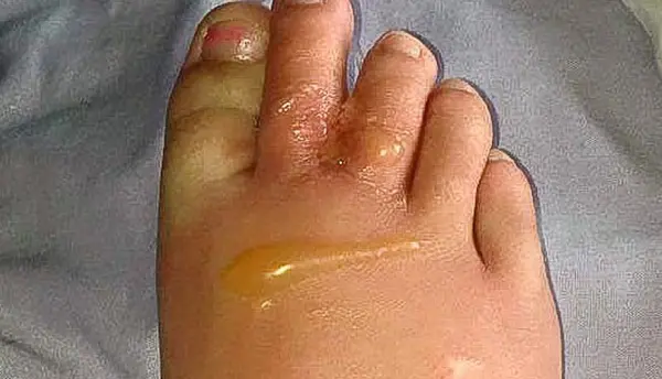 Salep Sagestam untuk Apa? Manfaat, Dosis, dan Cara Penggunaan yang ...