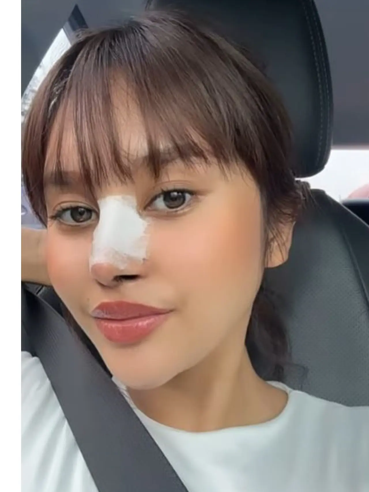 6 Potret Permesta Dhyaz Anak Farida Nurhan Oplas Hidung Lagi, Dulu ...