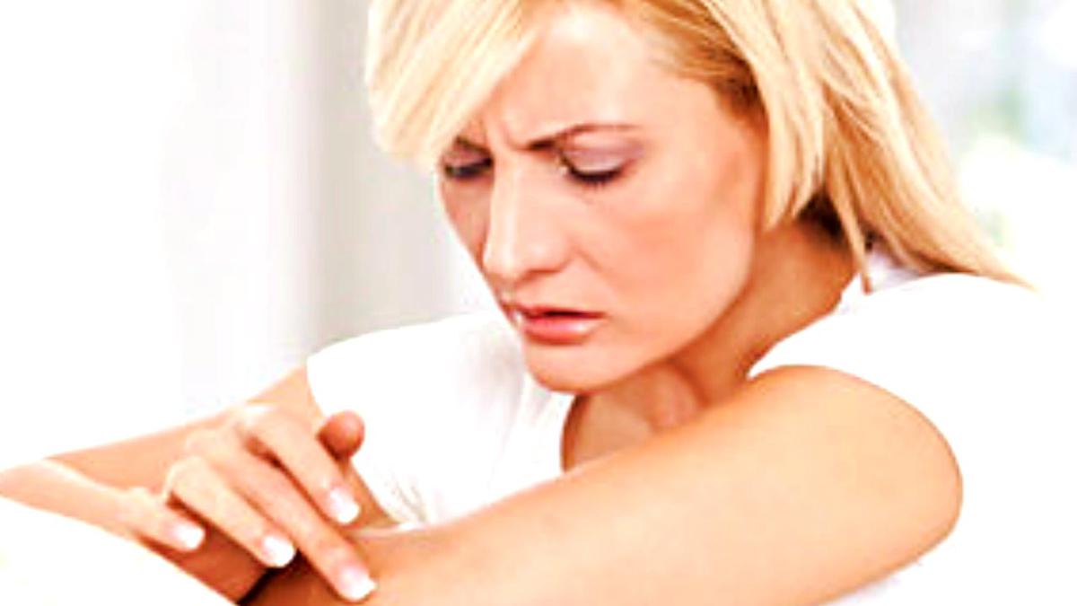 Penyakit Kulit yang Bisa Jadi Pertanda kuat HIV/AIDS - Health Liputan6.com