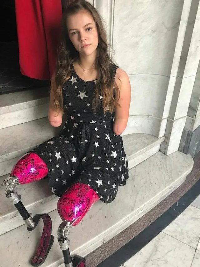 Jadi Atlet Senam hingga Pebalap Motor Tanpa Kaki-Tangan, Wanita Ini ...