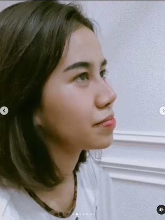 8 Potret Perubahan Wajah Mayang Usai Operasi Hidung, Sudah Lepas Perban