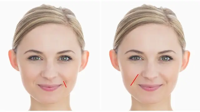 10 Arti Kerutan di Wajah, Jadi Tanda Kondisi Kesehatan - Hot Liputan6.com