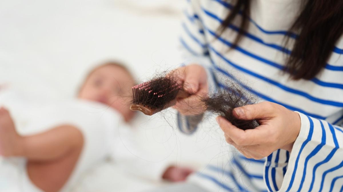 Rambut Rontok Setelah Melahirkan, Jangan Disepelekan! Intip Rekomendasi ...