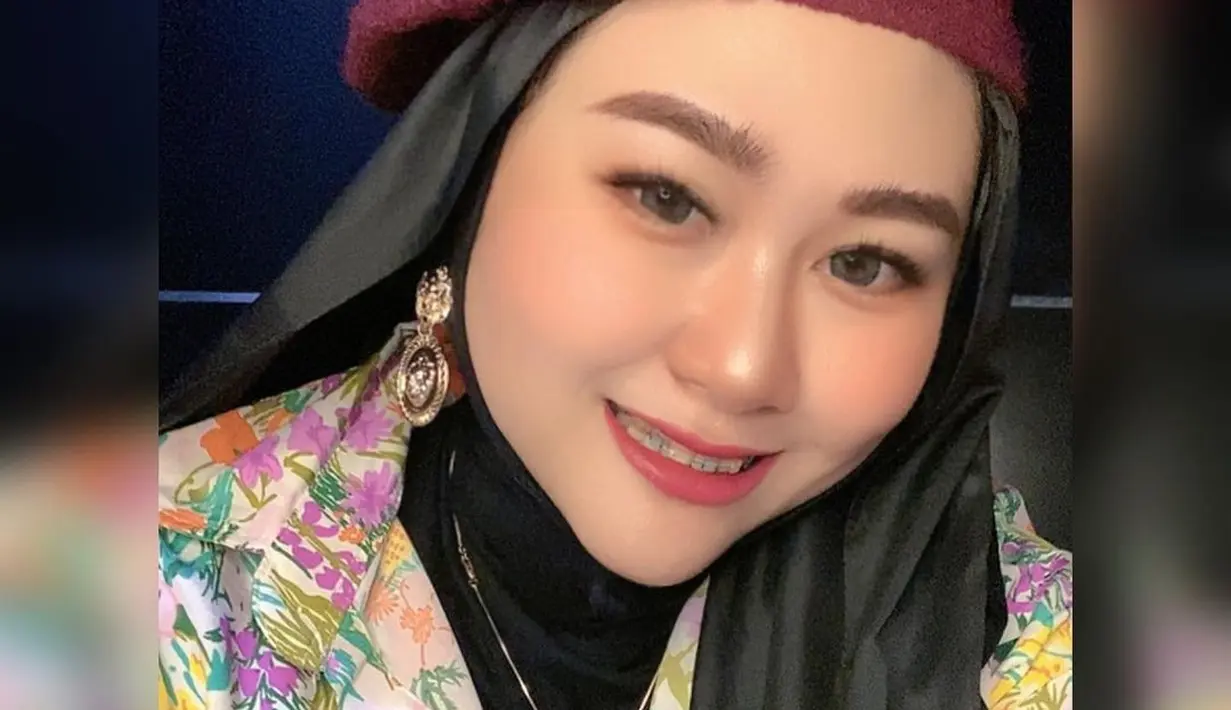 Potret Close Up Shelvie Hana Wijaya, Istri Daus Mini yang Gugat Cerai Sang Suami - Foto Liputan6.com