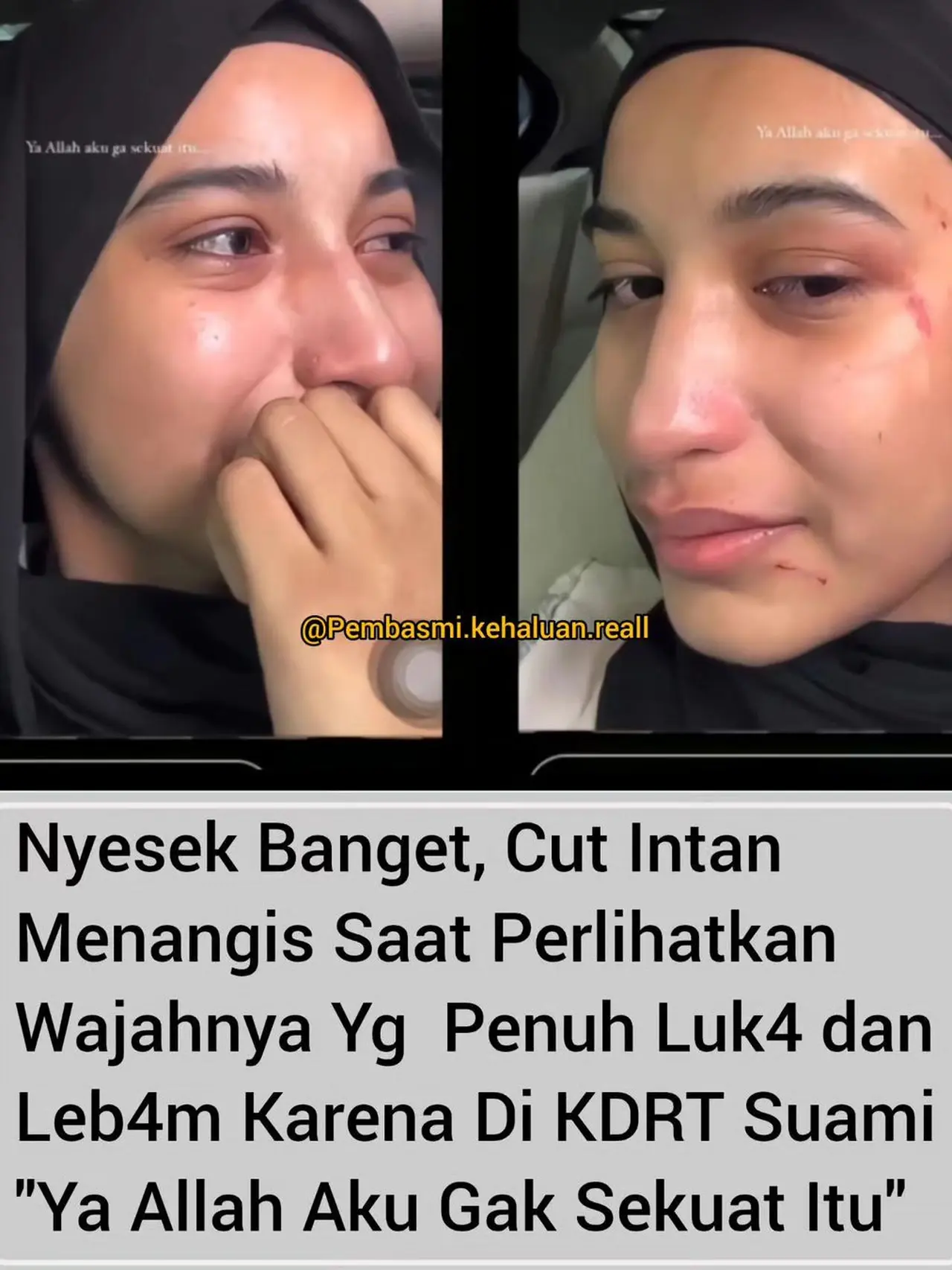Cut Intan Nabila Perlihatkan Wajah Lebam dan Luka, Tulis Keterangan ...
