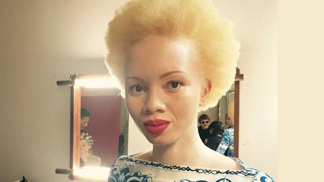 Thando Hopa, Model yang Albino pun Mendunia Seperti Diop - Citizen6 ...