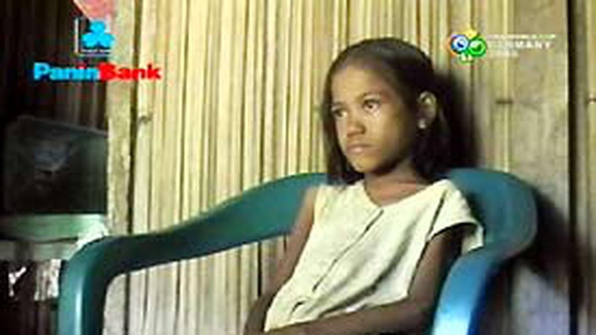 Kekurangan Biaya, Penderita Busung Lapar Menghentikan Pengobatan - News Liputan6.com