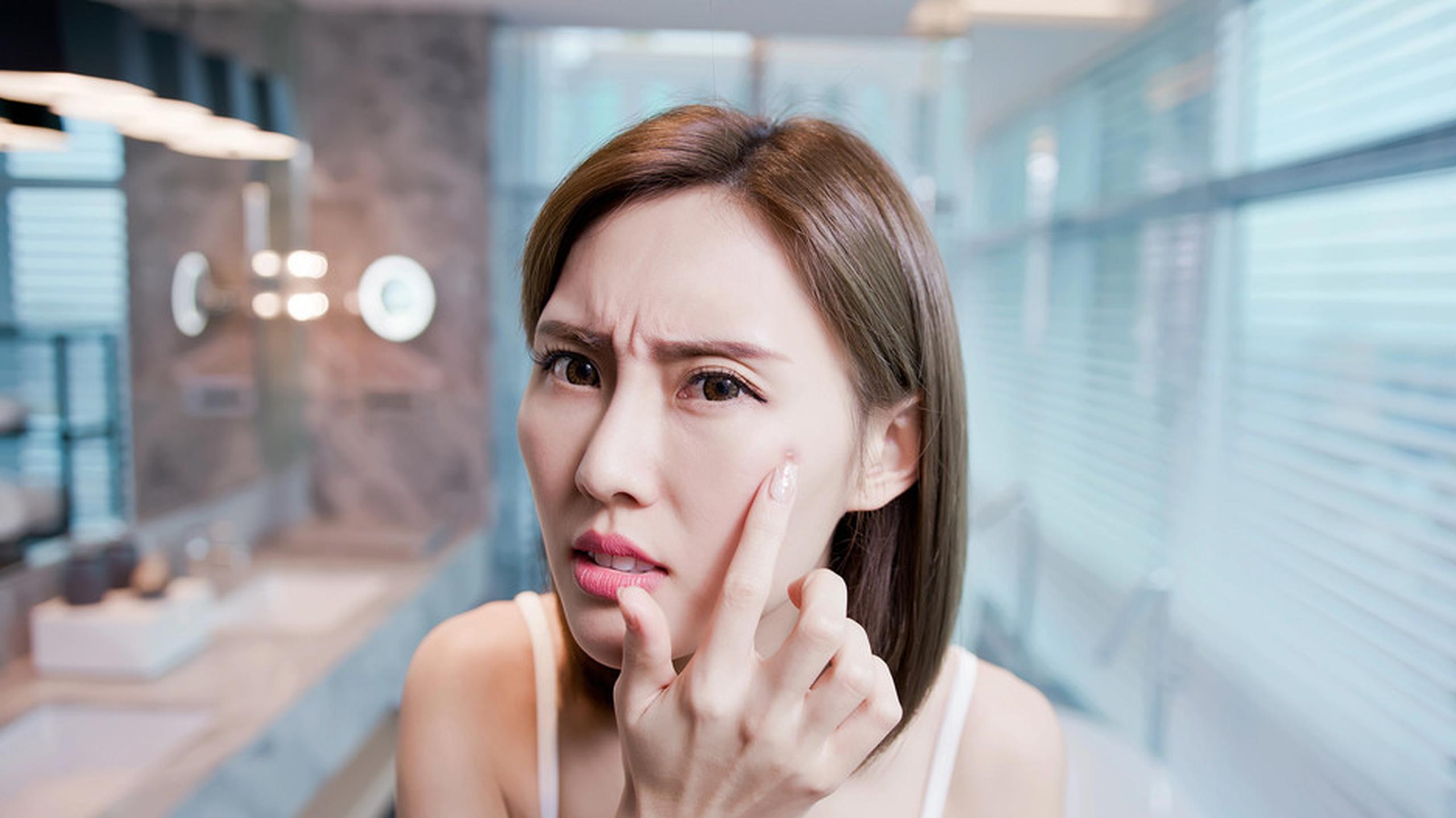 15 Tips Cara Menghilangkan Jerawat Secara Alami dan Efektif