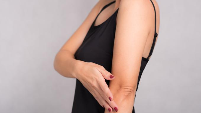 5 Penyebab Siku Hitam dan Cara Merawat yang Mudah dan Efektif - Beauty ...