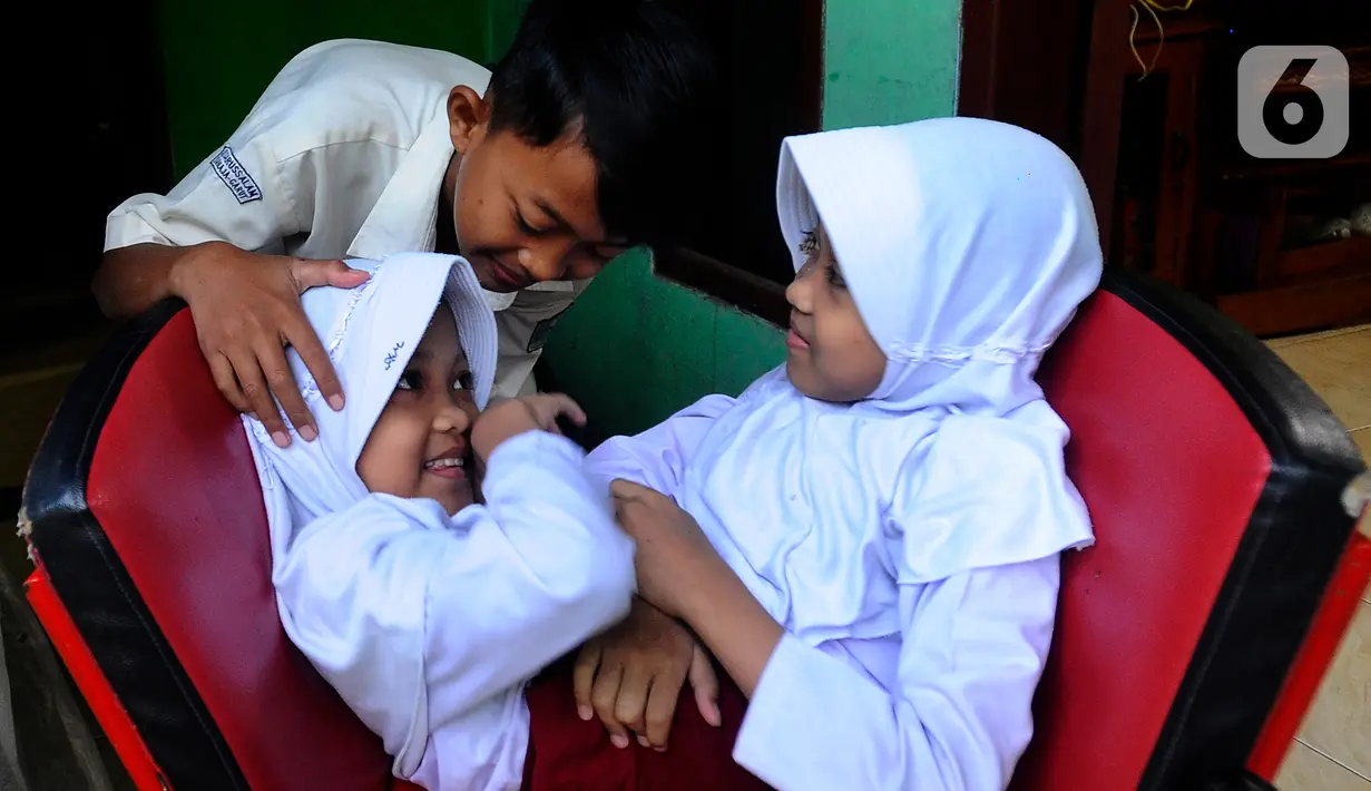 Potret Semangat Kembar Siam Al Dewi dan Al Putri Asal Garut - Foto Liputan6.com