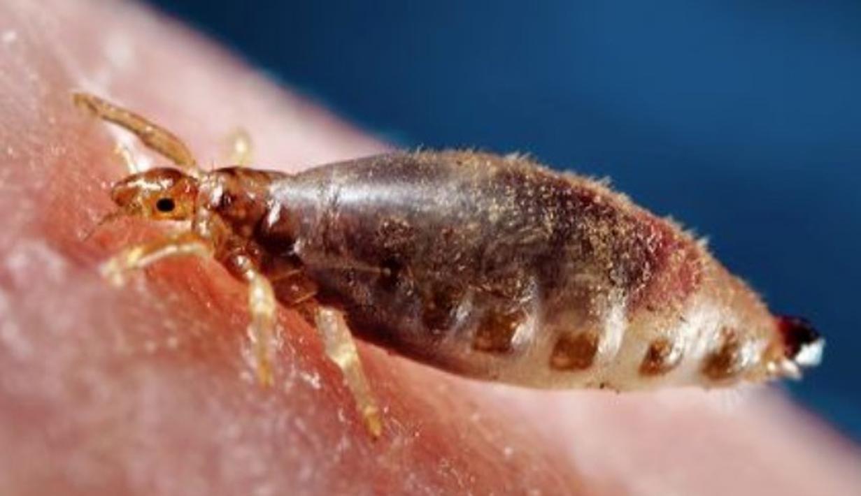 Beragam Parasit Tubuh Yang Bikin Anda Gatal Hanya Dengan Melihat ...