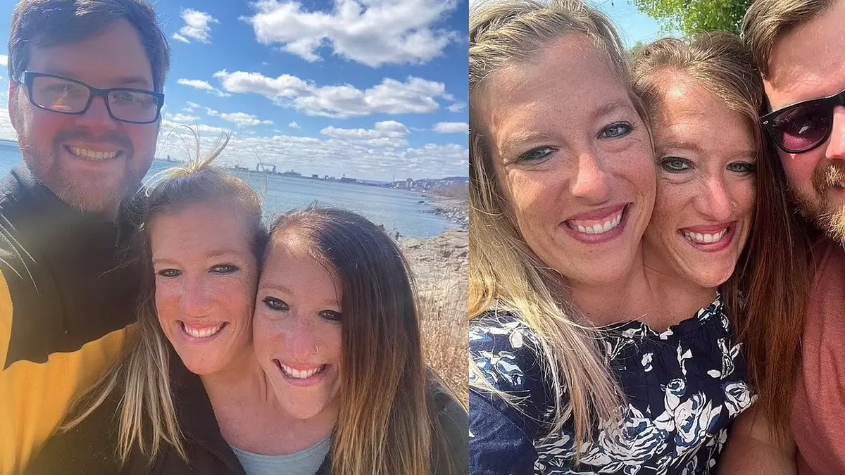 Berita Kembar Siam Dempet Hari Ini - Kabar Terbaru Terkini | Liputan6.com