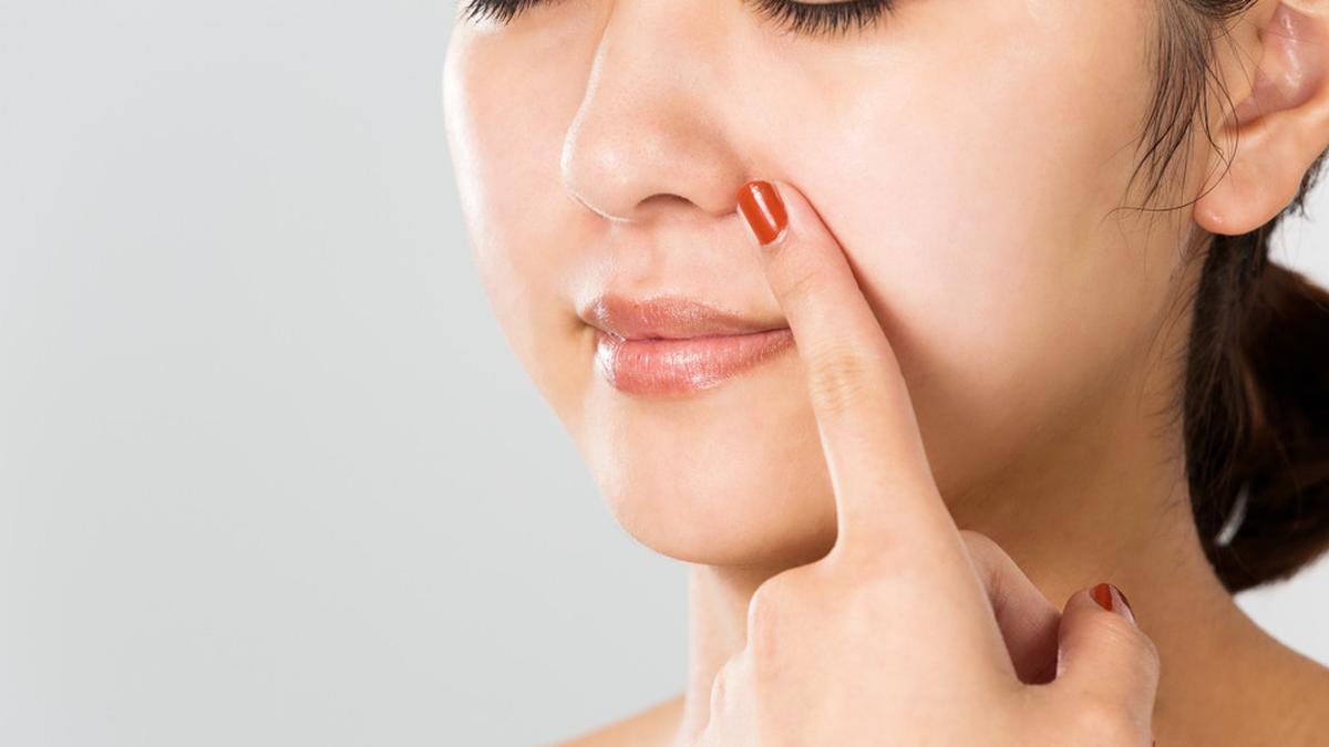 4 Langkah Efektif Atasi Blackhead, Si Komedo Hitam yang Mengganggu ...