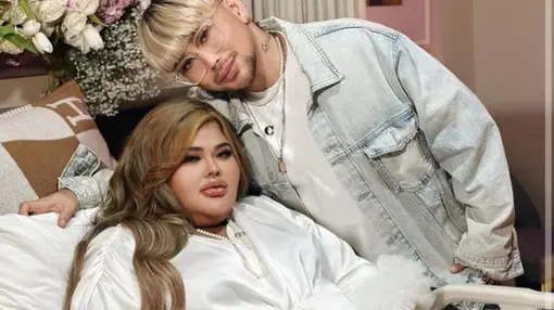 5 Sumber Kekayaan Shindy Samuel Viral Operasi Bariatrik, Jadi Bos Skincare - Hot Liputan6.com