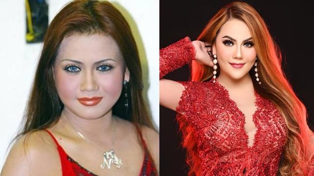 Beda Penampilan 9 Artis Sebelum vs Setelah Operasi Plastik, Bikin ...