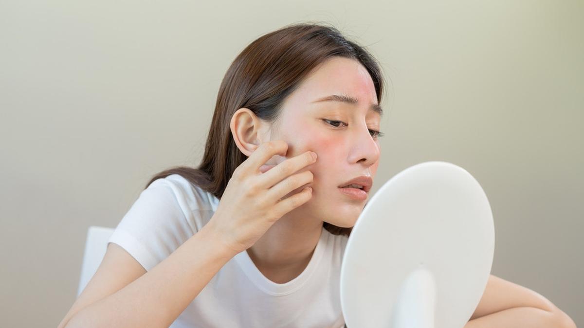 Jangan Salah! Ini 4 Tips Merawat Kulit Kering dan Sensitif