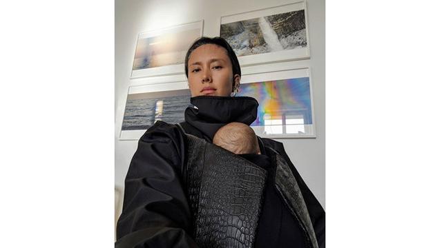 Ingat Pemeran Nyit-nyit di Sinetron Lupus? 6 Potret Terbarunya Bikin Pangling - Hot Liputan6.com