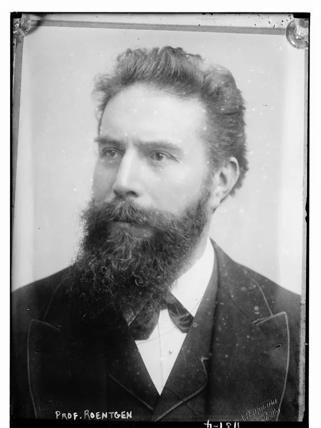 8 November 1895: Wilhelm Roentgen Menemukan X-Ray - Global Liputan6.com