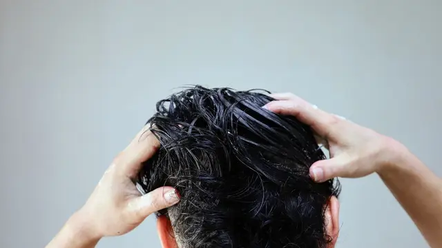 10 Penyebab Rambut Rontok pada Pria yang Berujung Kebotakan, Temukan ...