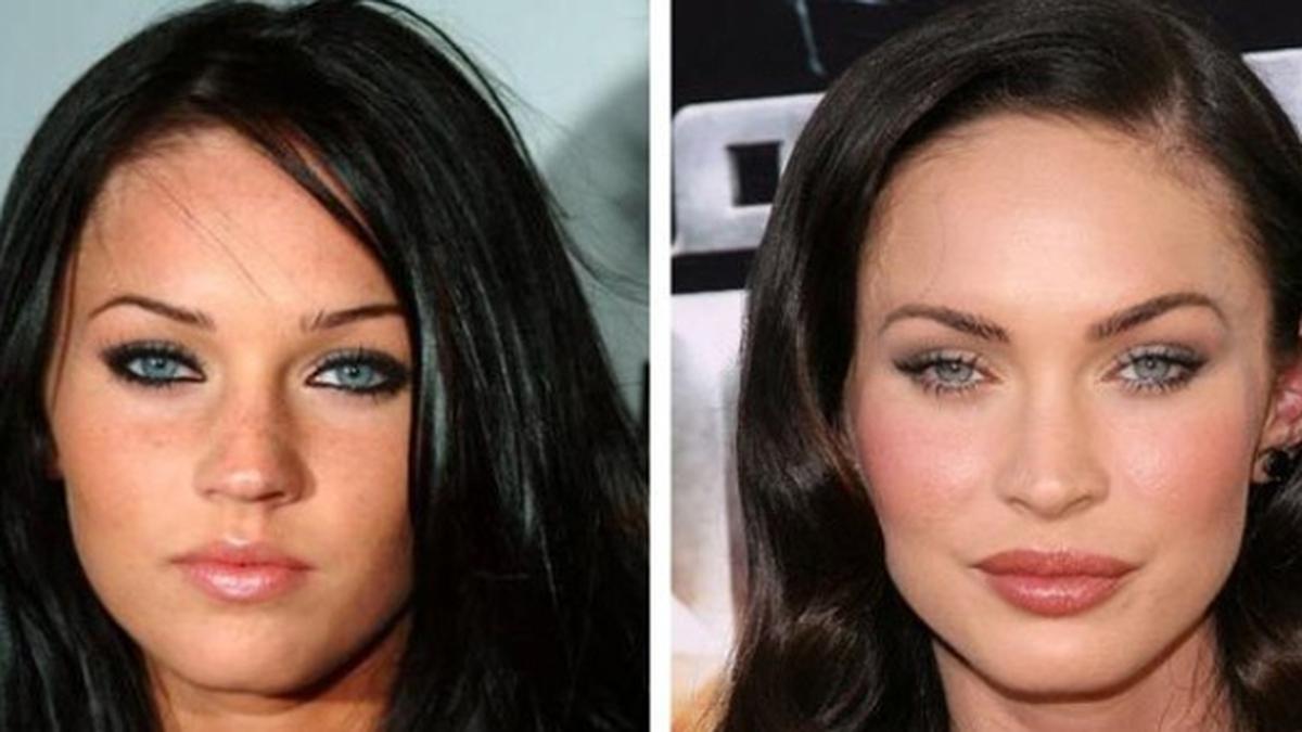 Foto Selebriti Sebelum Dan Sesudah Operasi Plastik - Photo Fimela.com