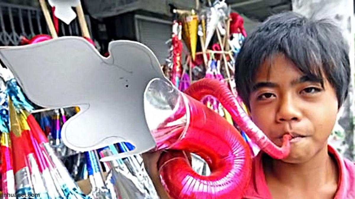 Dokter: Tiup Terompet Tidak Tularkan TBC - Health Liputan6.com